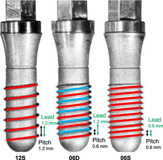 Figure 1 Implant Code 12S Is Similar To A Commercially Available